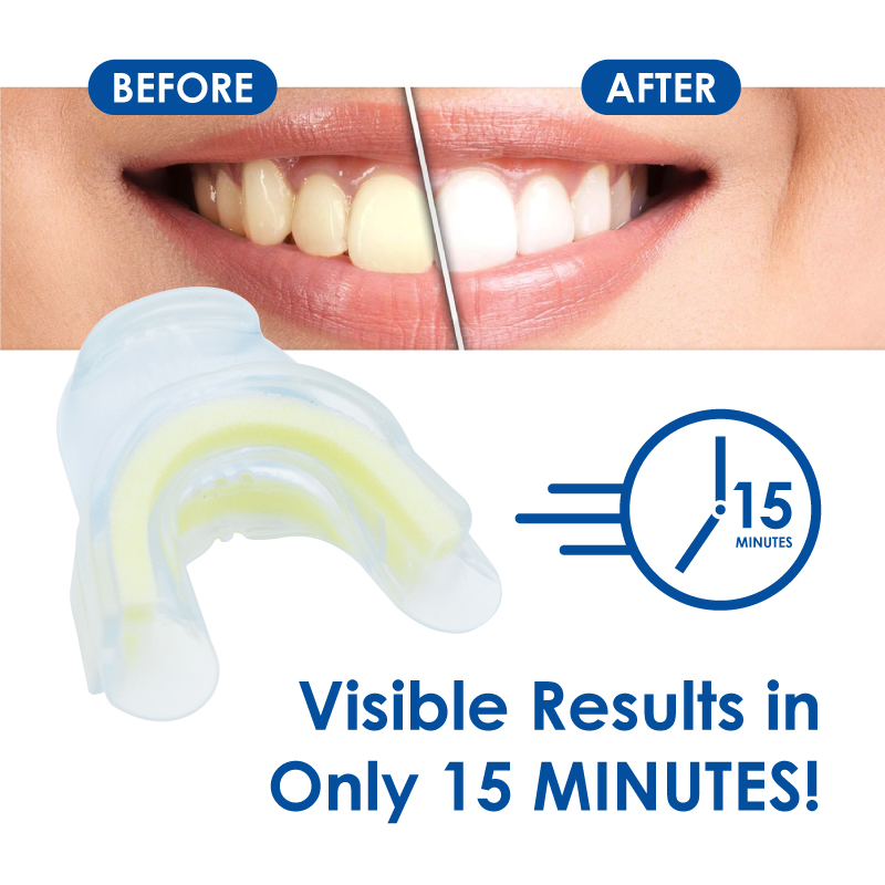 White Blitz Premium Prefilled Whitening Kit | Whiter Image