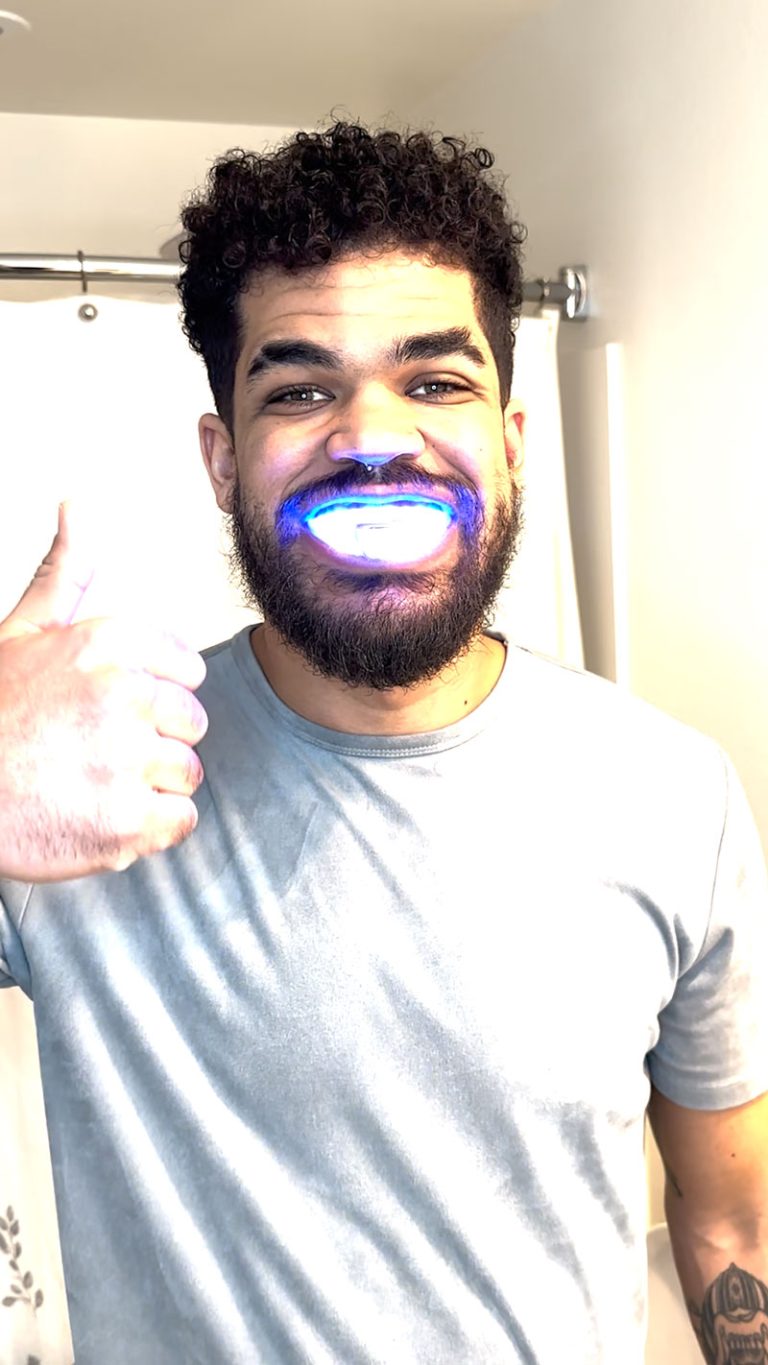 Professional Teeth Whitening Solutions | Whiter Image